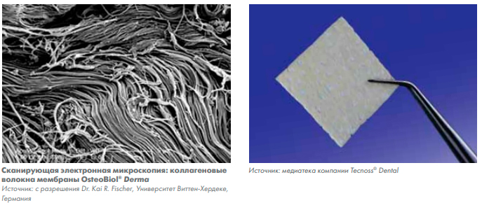 Osteobiol Derma Fine (свиной) 25х25мм (0,8-1,0мм)-дермальный матрикс с ...